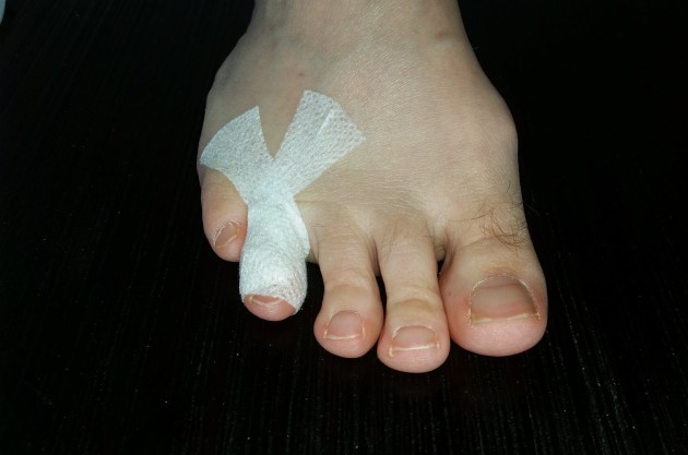 How to... keep your feet fit for your next hike - Great Walks